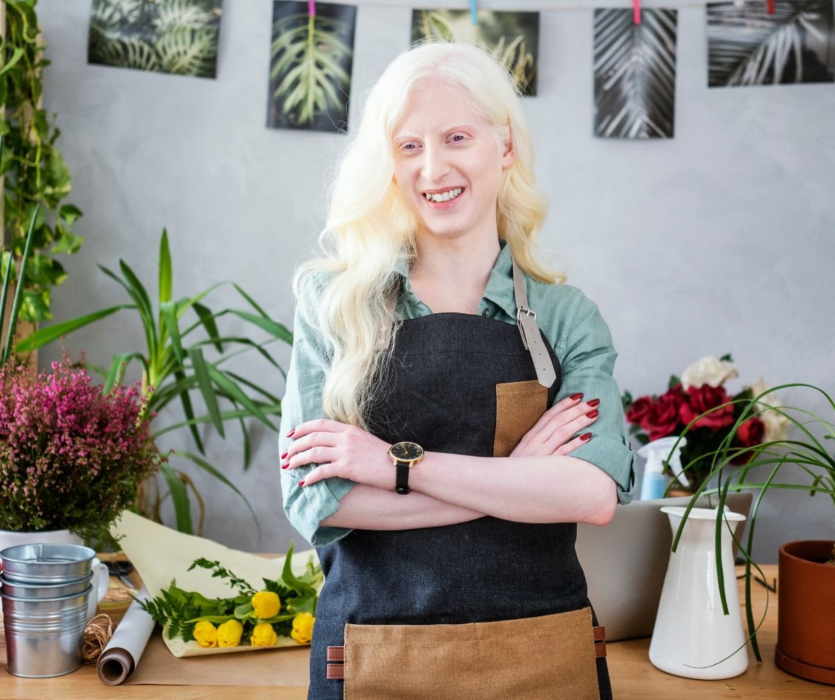 Redefining Beauty: The Strength and Confidence of Individuals with ...