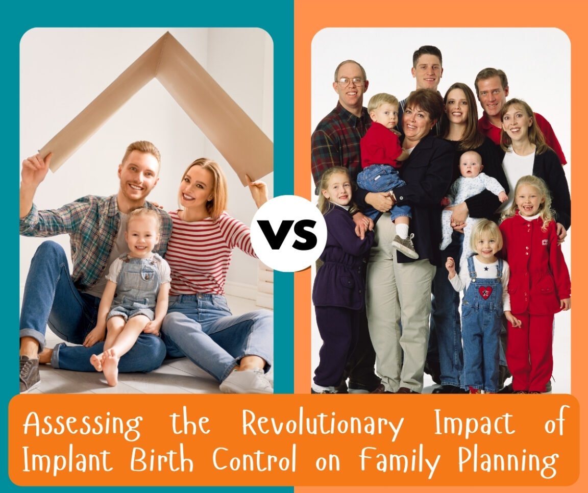 The Role of Implant Birth Control in Modern Family Planning - Ideas24